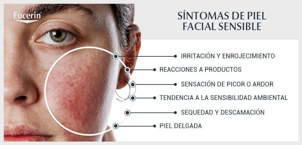 Piel sensible del rostro: signos y síntomas | Eucerin®